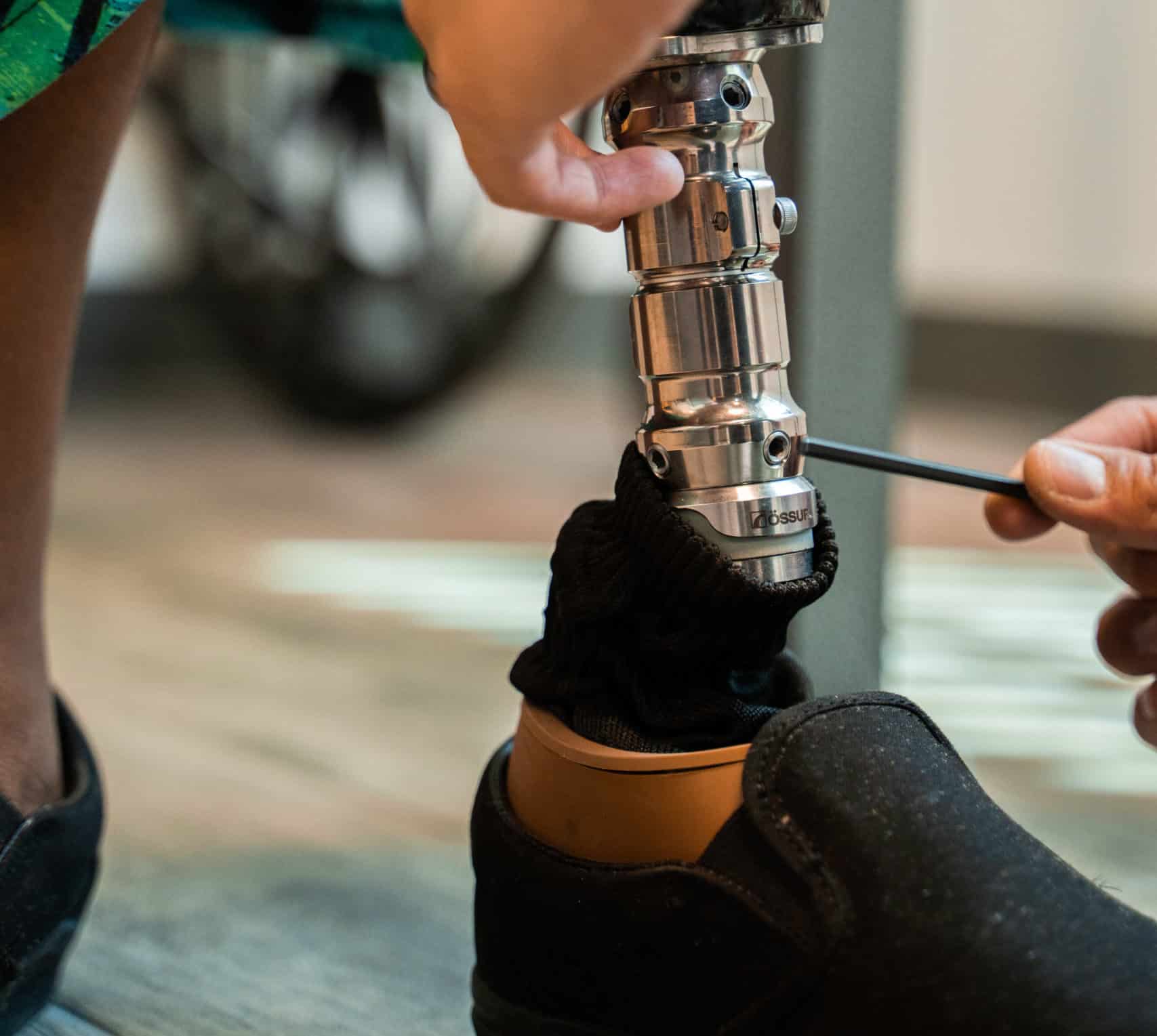 Lower Limb Prosthesis - Pongratz Orthotics & Prosthetics