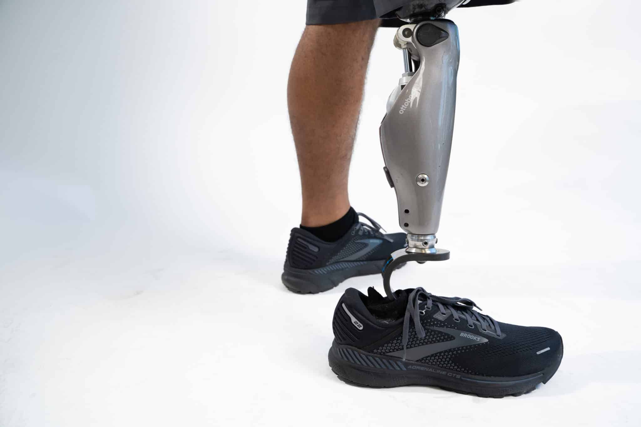 Lower Limb Prosthesis - Pongratz Orthotics & Prosthetics