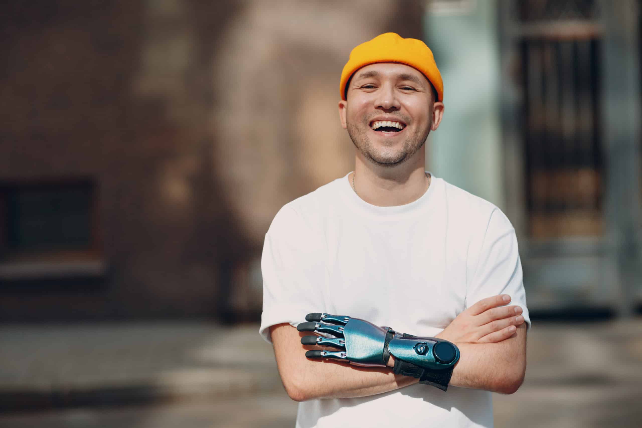 What to Know Before Getting a Prosthetic Arm - Pongratz Orthotics ...