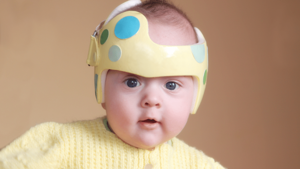 How to Care for a Cranial Band - Pongratz Orthotics & Prosthetics